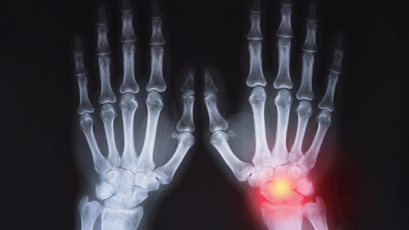 Advantages and Disadvantages of Taking an X-ray - Tech Quintal Advantages and Disadvantages of Taking an X-ray - Tech Quintal