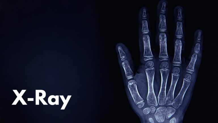 7 Different Types of X-Rays - Tech Quintal