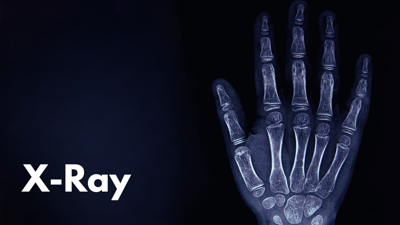 7 Different Types of X-Rays - Tech Quintal